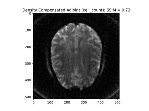 Gpu Density Compensation Reconstruction Comparison — Pysap V0 2 1