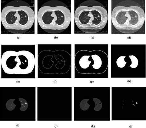 Segmentation Results Of Approach Ii Thresholding K Means