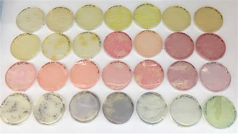 How To Calculate Transfection Efficiency Pediaa Com