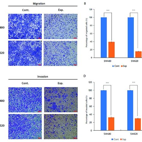 Migration And Invasion Confirmation Test By Sitspan5 A Evaluation Of Download Scientific