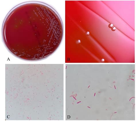 Letter To The Editor Necrotizing Suppurative Dermatitis Caused By Massilia Oculi In An