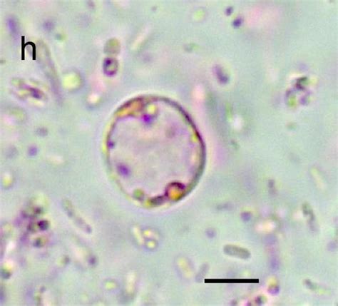 Gut Microbe Could Hold A Key To Help People Benefit From Healthy Foods
