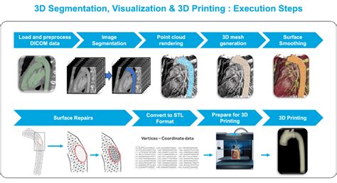 Three Dimensional Visualization And Printing Of Cardiac Anatomy For