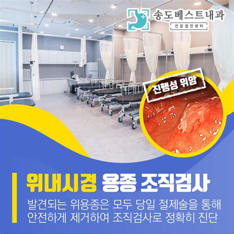 위내시경 조직검사 결과 위염 위궤양 위암 네이버 블로그