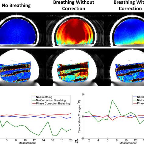 Modified Segmented Epi Sequence With Flyback Readout Fid Phase Download Scientific Diagram