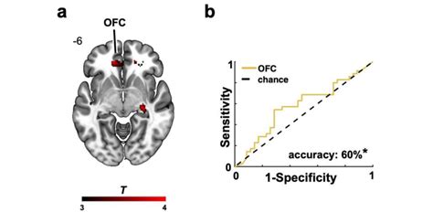 Neural Correlates Of The Negativity Bias A A Stronger Download Scientific Diagram