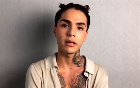 Leo Méndez Jr Genera Preocupación Al Mostrar Ojo Moreteado