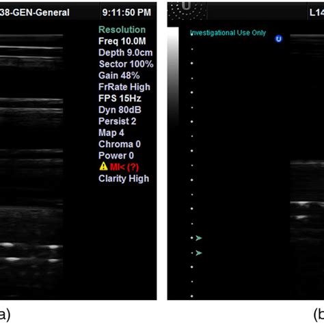 Modified Synthetic Transmit Aperture Imaging A High Resolution Image