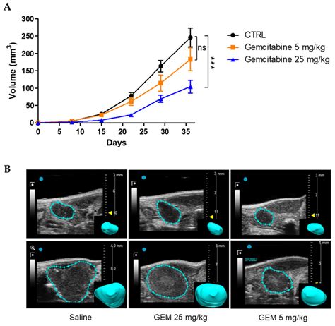 Effects Of Gemcitabine In The Orthotopic Xenograft Pdac Mouse Model