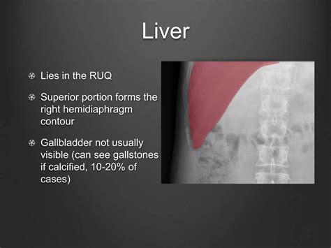 Approach To Pfa Interpretation Pptx