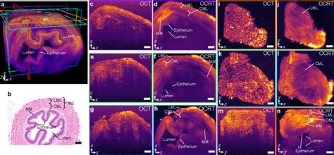 Figure 1 From Computational 3d Microscopy With Optical Coherence
