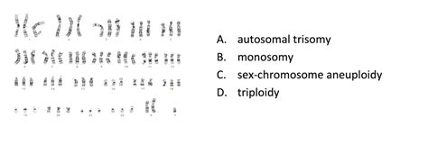 Solved The A Autosomal Trisomy B Monosomy C