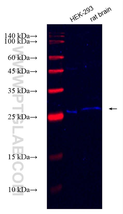 Scn3b Antibody Cl750 82959 7 Proteintech Scn3b Antibody Cl750 82959 7 Proteintech