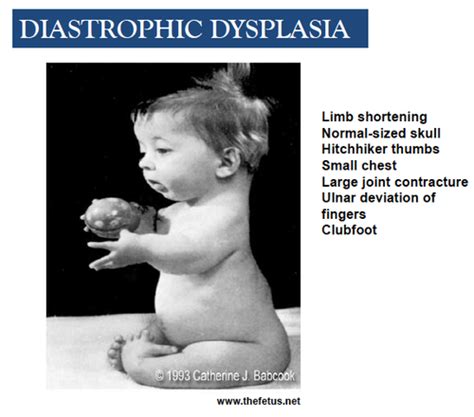 Systemic Defects Pathology Unit Flashcards Quizlet
