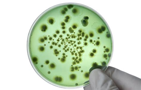 Colony Forming Units Calculation