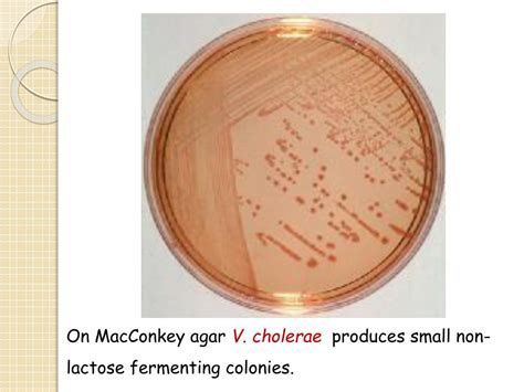 Ppt Pseudomonas Powerpoint Presentation Free Download Id2269529