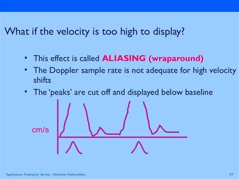 Basics Physics Of Ultrasound Artofit