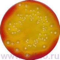 105287 XLD agar - Питательная среда - Ксилозо-лизин-дезоксихолатный ...