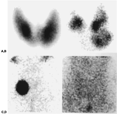 Applications Techniques And Interpretation Of Radionuclide Imaging