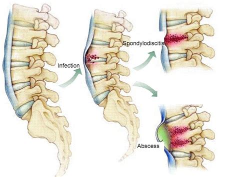 Заболявания и лечение неврохирург