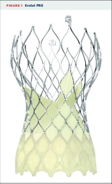 Figure 1 From The Latest Evolution Of The Medtronic Corevalve System In