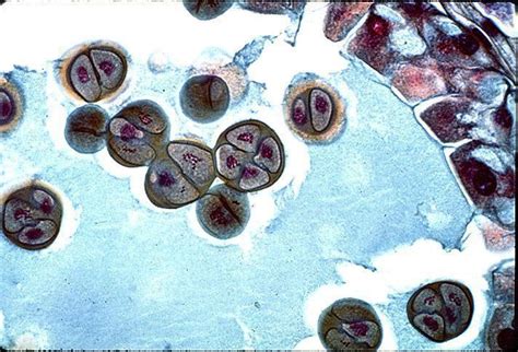 Microspore Alchetron The Free Social Encyclopedia