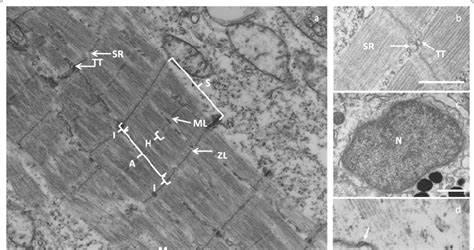 Electron Micrographs Of Structures In Cardiomyocytes Of A Scc Generated