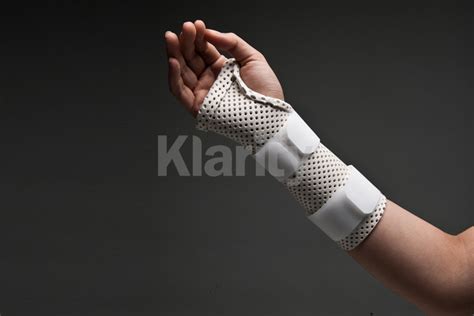 China Radial Bar Wrist Cock Up Splint Thermoplastic Precut Splint