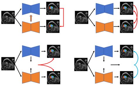 논문 리뷰 Learnable Prompting Sam Induced Knowledge Distillation For Semi