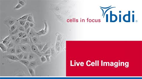 Live Cell Imaging An Overview For Beginners Lab Solutions By Dksh