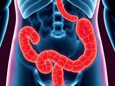 Microbiota Intestinal Y Su Papel En El Desarrollo De La Apendicitis