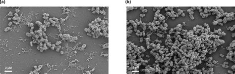 A Combination Aldehyde Fixative Solution Is Superior To Glutaraldehyde Download Scientific