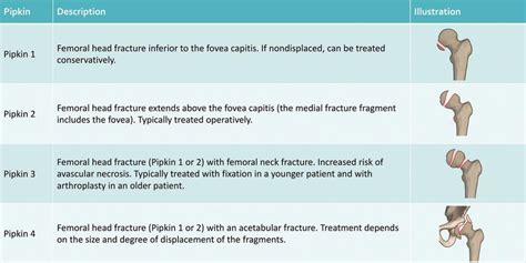 Question 215523 Qbank Orthobullets