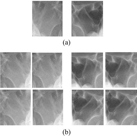 Samples Of Conventional Data Augmentation A Horizontal Flip B