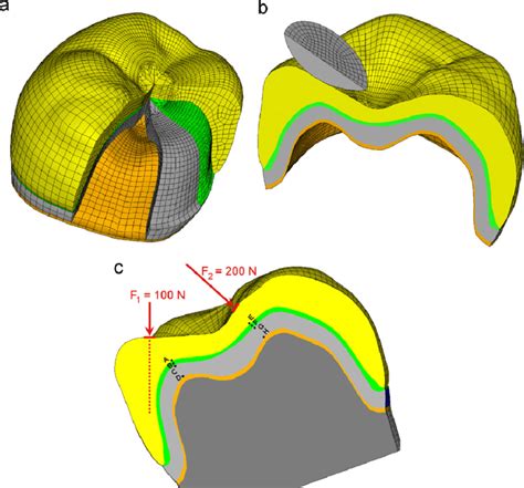 A Meshed Fe Model Crown B Section Through The Complete Fe Model Download Scientific