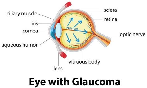 Glaucoma Detection Damage Assessment Via Deep Learning