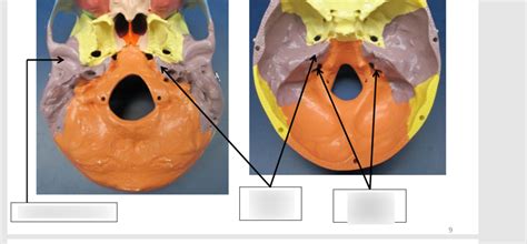 Skeletal Temporal 2 Diagram Quizlet