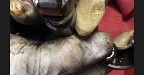 Ground Lifter Album On Imgur