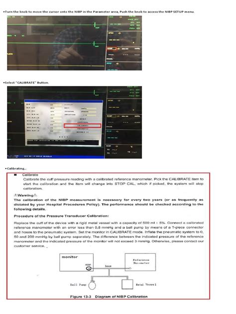 Nibp Calibration Pdf Nibp Calibration Pdf