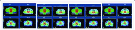 Comparison Of The Dosimetry Comparison Of The Radiobiological Download Scientific Diagram