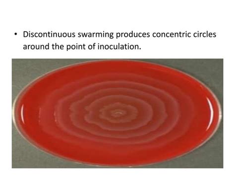 Proteus Spp Lecture Pptx