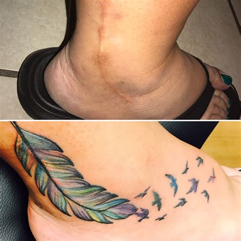 Best Tattoos To Cover Up Scars At Nate Nail Blog