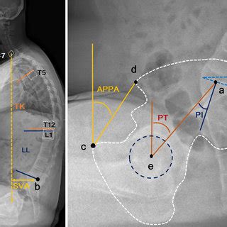 Three Arc Types Of Pelvic Motion From Standing To Sitting Positions A Download Scientific