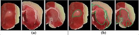 A Schematic Diagram Of Image Binarization A The Results Of
