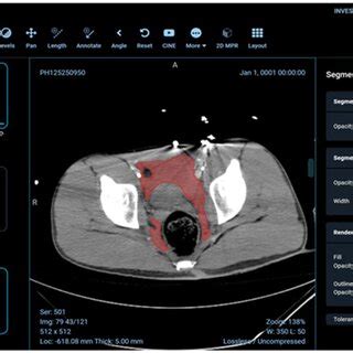 Client Side Display Of DICOM Images Segmentation Mask And A Download Scientific Diagram