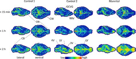 Spatiotemporal Distribution Of Gd Dota Accumulation In Brain Tissue And