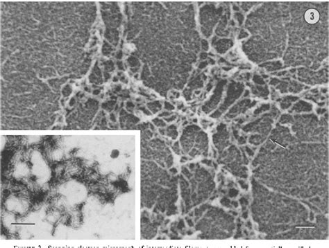 Figure 3 From High Resolution Scanning Electron Microscopy Of Isolated And In Situ Cytoskeletal