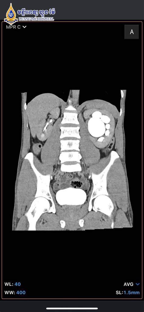 មន្ទីរពេទ្យ ហ្លួង ម៉ែ Luang MÈ Hospital Phnom Penh