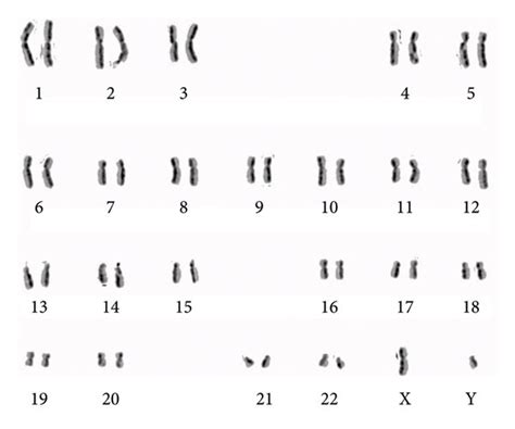 Sample Sce Metaphases A Control As Mmc B Gpe3 100 μm
