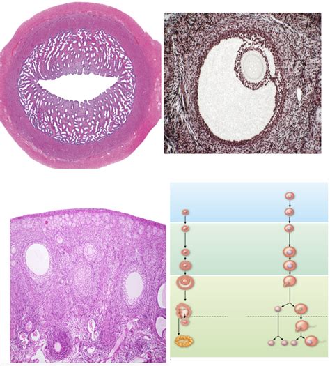 Chapter 27 Female Reproductive System Part 2 Diagram Quizlet